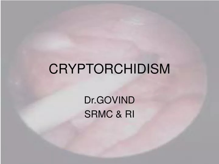 PPT - CRYPTORCHIDISM PowerPoint Presentation, free download - ID:474422
