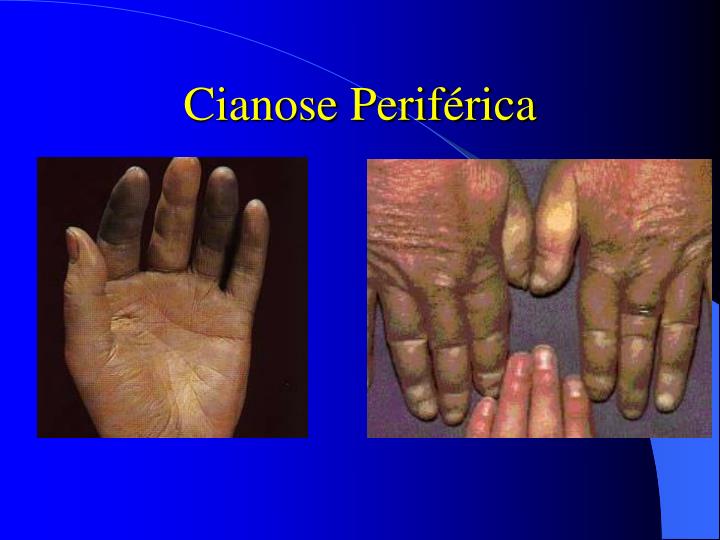 PPT - Exame Físico Geral PowerPoint Presentation - ID:474575