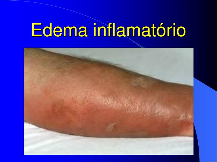 PPT - Exame Físico Geral PowerPoint Presentation - ID:474575