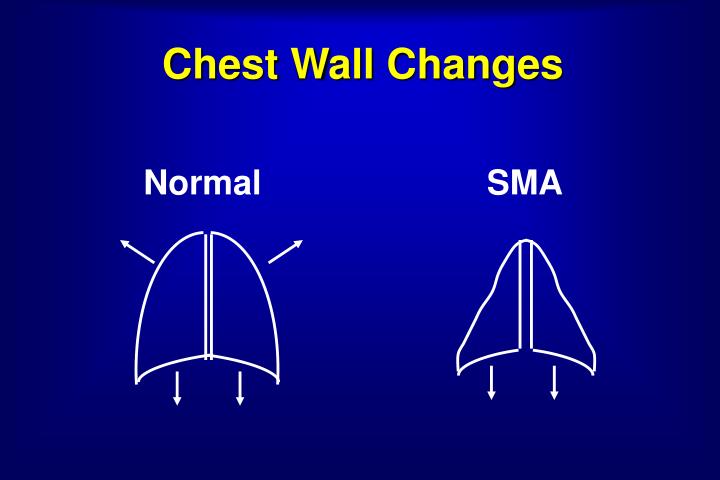 PPT - KEEPING YOUR LUNGS HEALTHY: SMA TYPE II and III PowerPoint ...