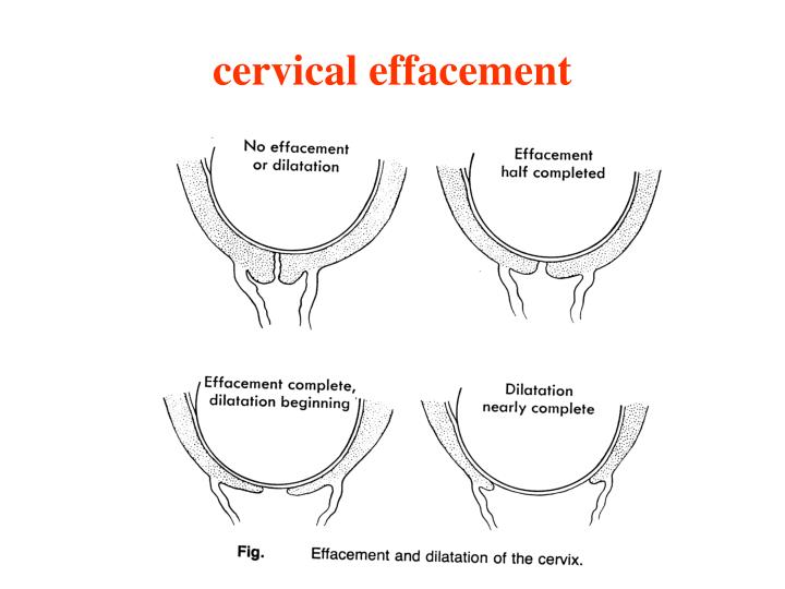 PPT - Normal labor and delivery PowerPoint Presentation - ID:475415