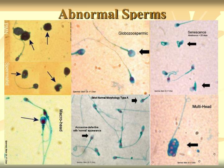 Ppt Semen Analysis And Sperm Preparation Powerpoint Presentation Id
