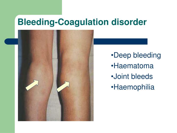 PPT - Bleeding Disorders Vascular and Platelet Disorders PowerPoint ...