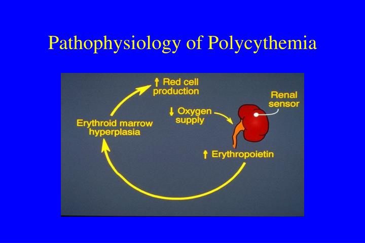 PPT - Polycythemia Vera (lots of red cells - for real) PowerPoint Presentation - ID:477262