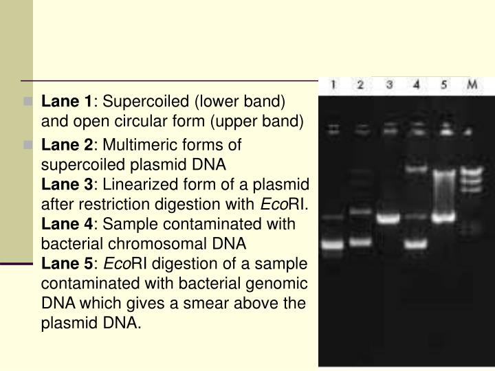 PPT - Plasmid DNA Isolation PowerPoint Presentation - ID:477427