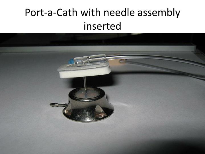 PPT - Port-A- Cath PowerPoint Presentation - ID:480351