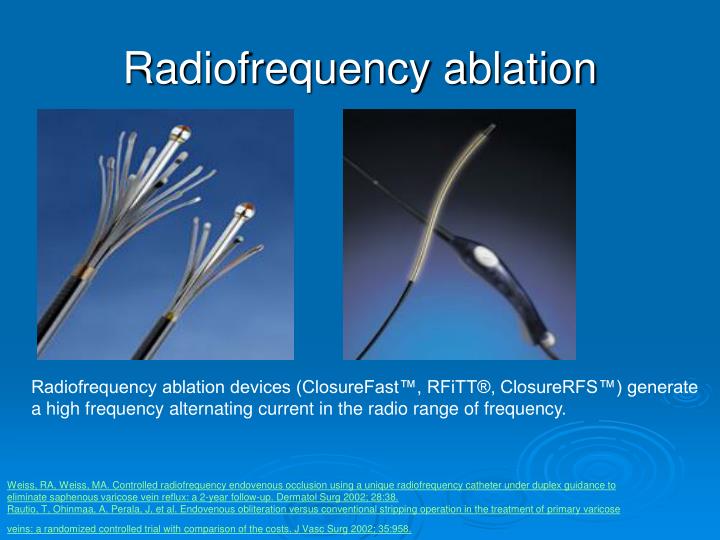 PPT - Update on Chronic Venous Disease Treatment PowerPoint ...