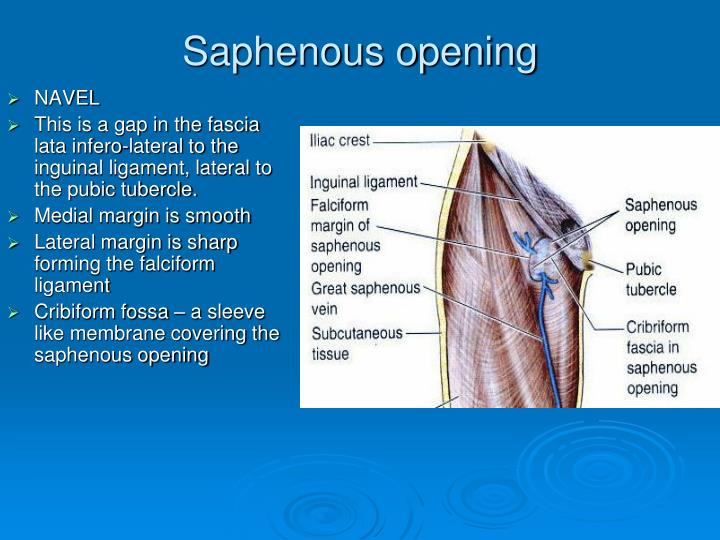 PPT - Update on Chronic Venous Disease Treatment PowerPoint ...
