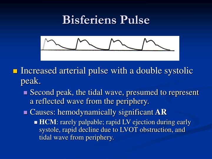 PPT - Pulse PowerPoint Presentation - ID:485278