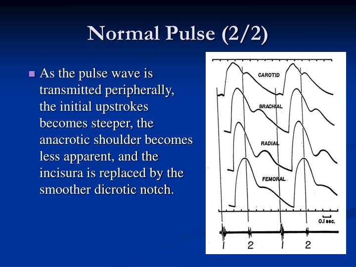 PPT - Pulse PowerPoint Presentation - ID:485278