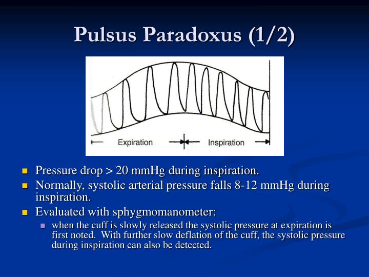 PPT - Pulse PowerPoint Presentation - ID:485278