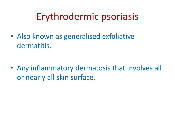 PPT - Psoriasis PowerPoint Presentation - ID:485860