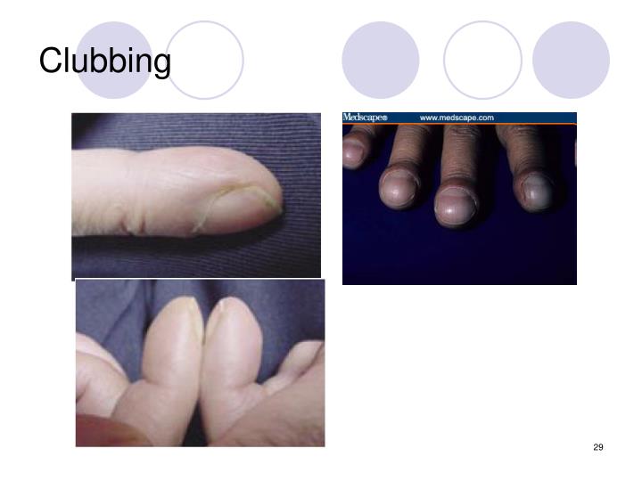 PPT - SKIN DISORDERS PowerPoint Presentation - ID:488081