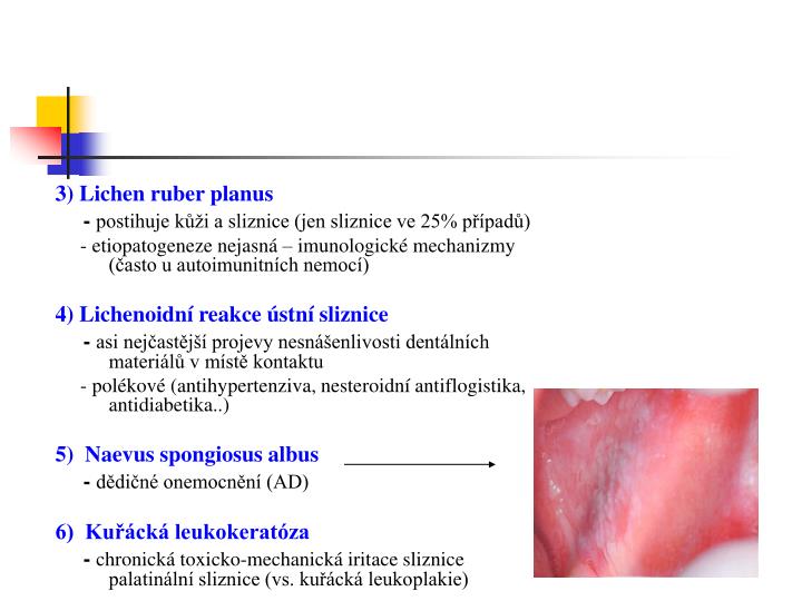 PPT - Nemoci dutiny ústní PowerPoint Presentation - ID:489608