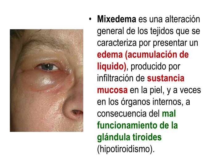 PPT - Etimologías griegas PowerPoint Presentation - ID:491200