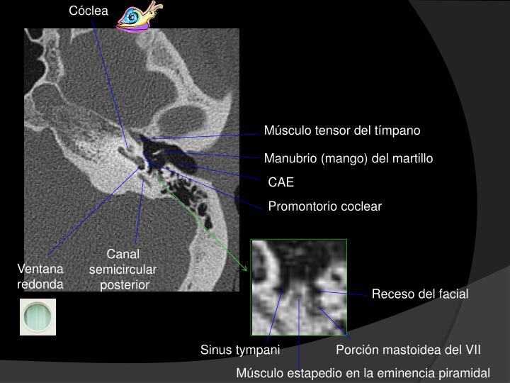 PPT - Atlas anatómico del hueso temporal PowerPoint Presentation - ID ...