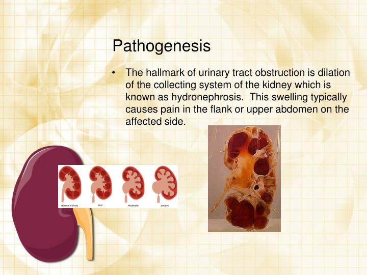 PPT - Urology Case PowerPoint Presentation - ID:494835