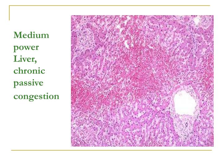 PPT - Hemodynamic Disorders PowerPoint Presentation - ID:494901