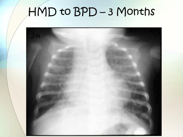 PPT - Neonatal Diseases PowerPoint Presentation - ID:495538