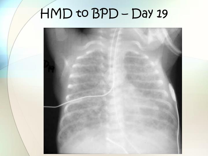PPT - Neonatal Diseases PowerPoint Presentation - ID:495538