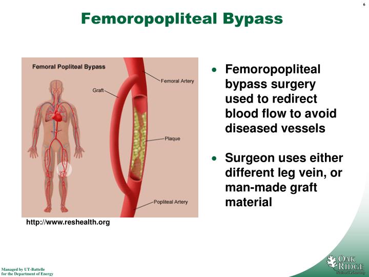 PPT - Hormone Replacement Therapy: Friend or Foe? PowerPoint ...