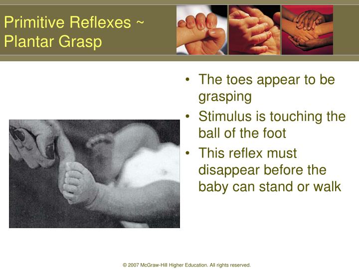 PPT - Infant Reflexes and Stereotypies PowerPoint Presentation - ID:498797