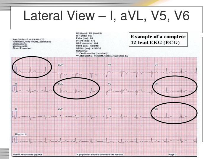 PPT - Rhythm & 12 Lead EKG Review PowerPoint Presentation - ID:504681