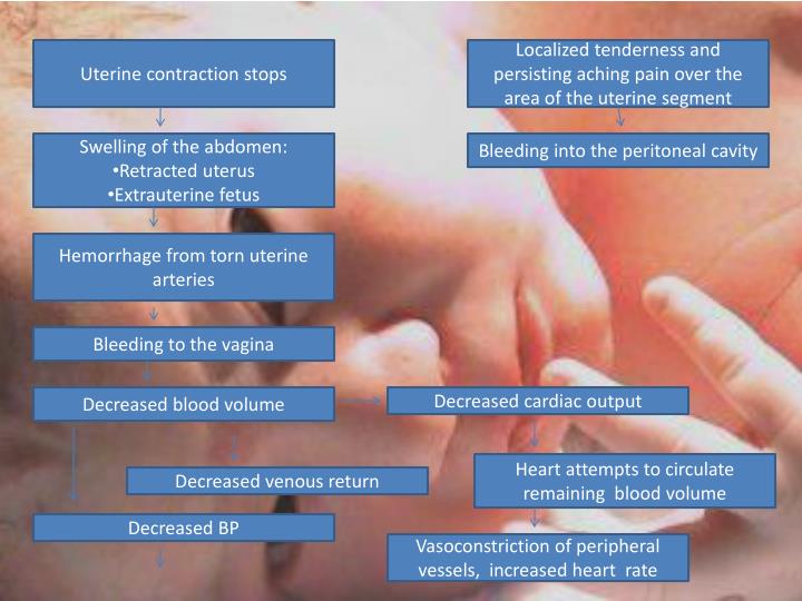 PPT - UTERINE RUPTURE PowerPoint Presentation - ID:506056