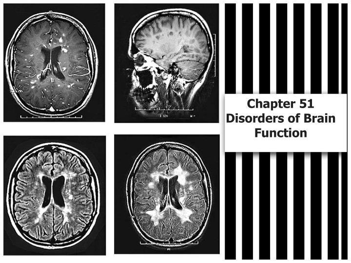 PPT - Chapter 51 Disorders of Brain Function PowerPoint Presentation ...