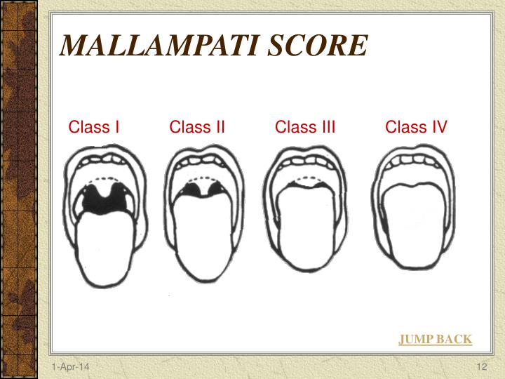 PPT - RSI: Rapid Sequence Intubation What, When, Where, Why & How ...
