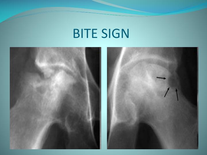 PPT - SIGNS IN RADIOLOGY PowerPoint Presentation - ID:510632