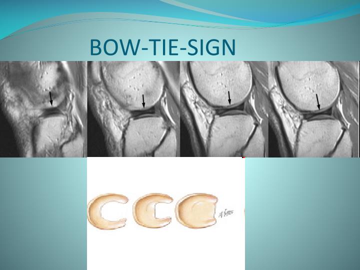 PPT - SIGNS IN RADIOLOGY PowerPoint Presentation - ID:510632