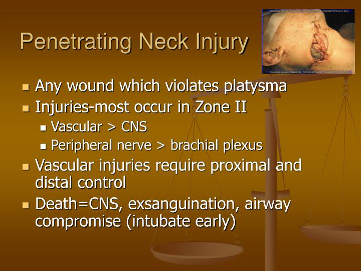 PPT - Trauma Board Review Part I PowerPoint Presentation - ID:516749