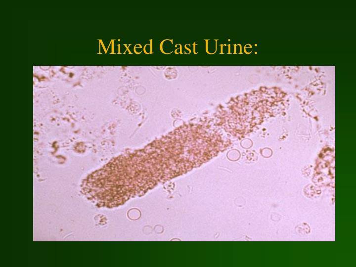 PPT - Urine Microscopy PowerPoint Presentation - ID:518534