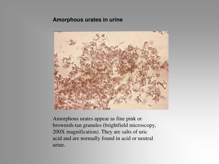 PPT - Urine Microscopy PowerPoint Presentation - ID:518534