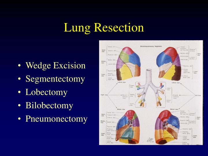 PPT - Common Thoracic Procedures PowerPoint Presentation - ID:520658