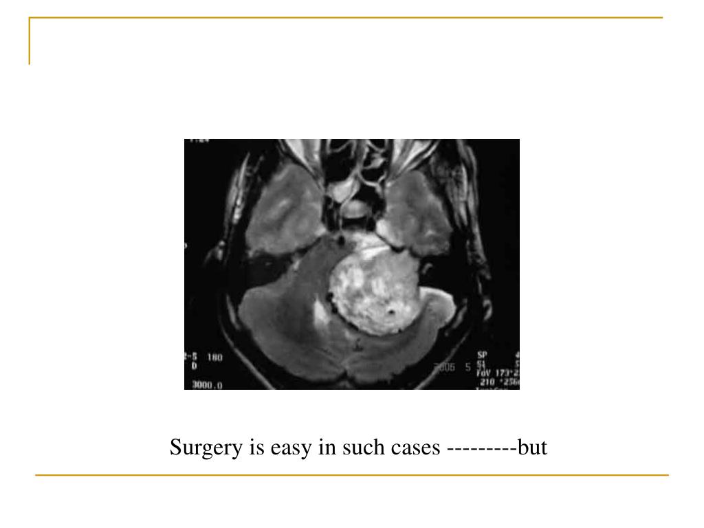 PPT - Accuracy of intra-operative rapid diagnosis by Squash smear in ...