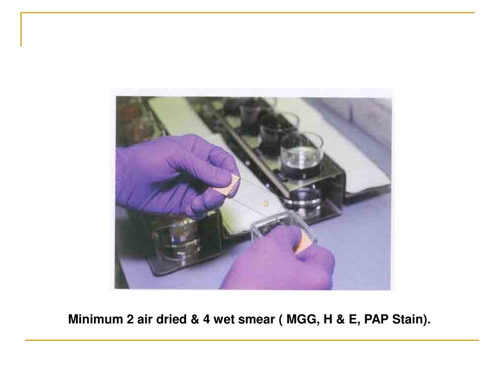 PPT - Accuracy of intra-operative rapid diagnosis by Squash smear in ...