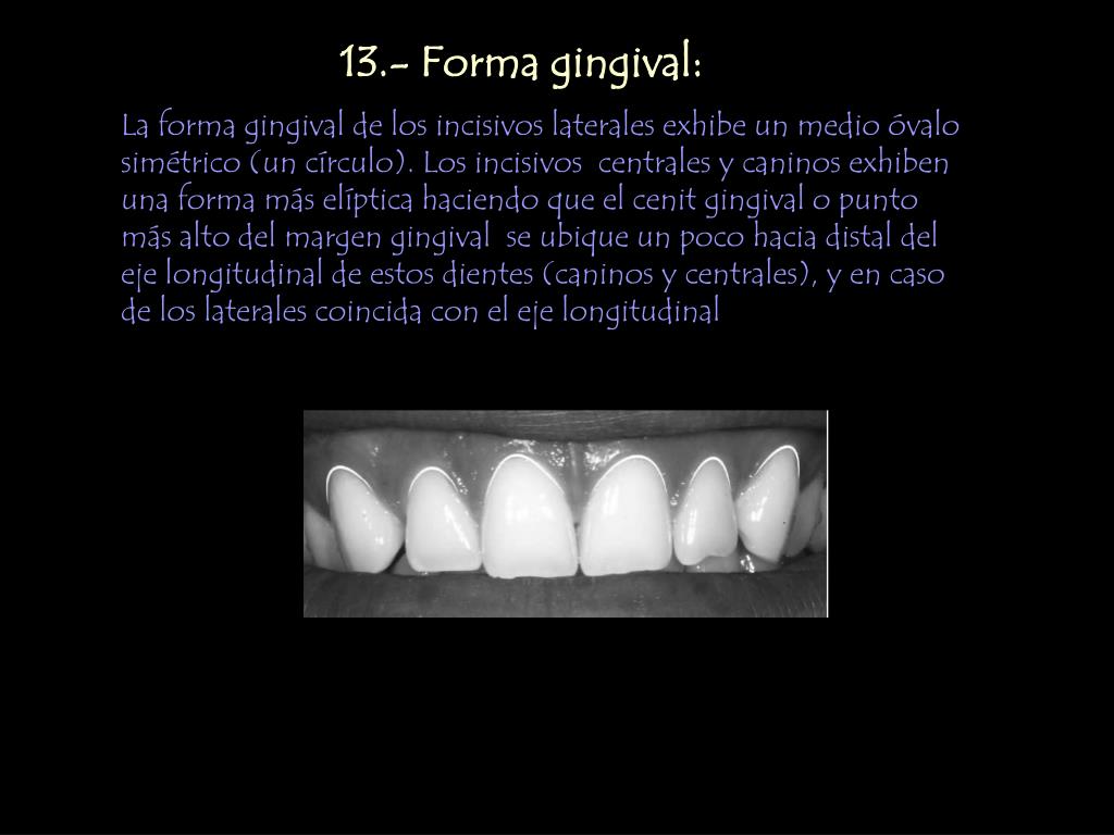 PPT - ESTÉTICA DENTARIA Y DENTOGINGIVAL PowerPoint Presentation, free ...