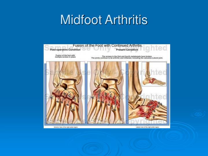 PPT - The Foot PowerPoint Presentation - ID:5358
