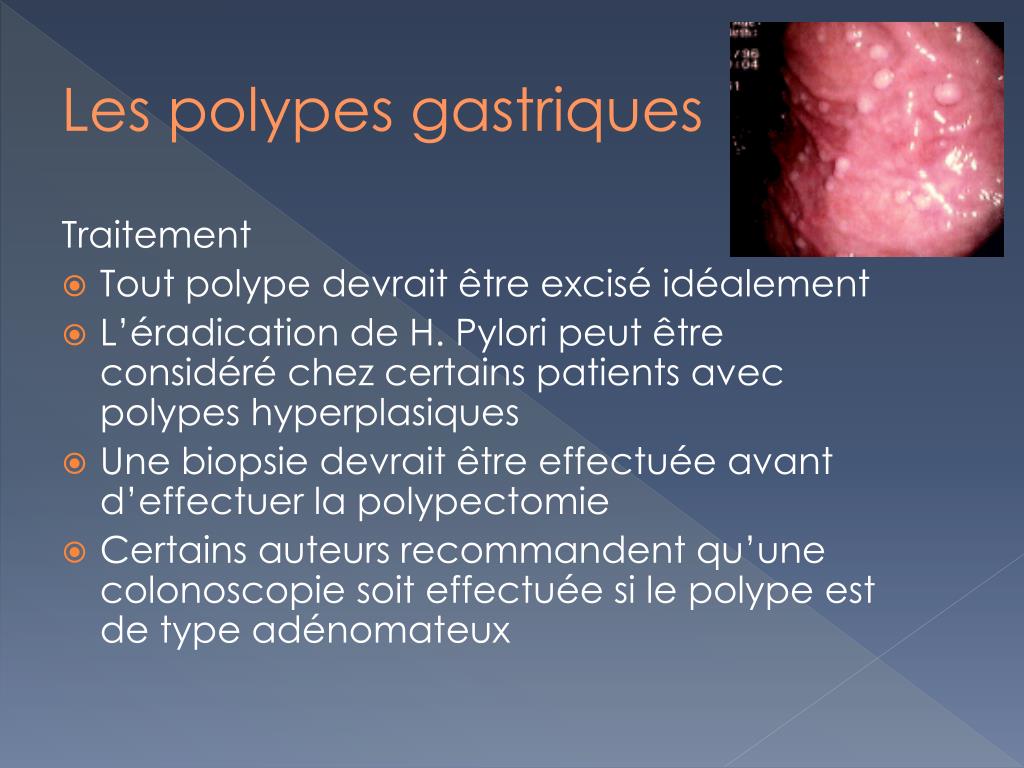 PPT - Polypes gastriques, gastrite atrophique et autres trouvailles ...