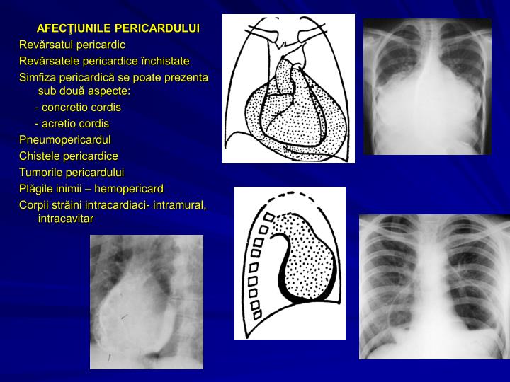 PPT - DIAGNOSTICUL RADIOIMAGISTIC AL AFECŢIUNILOR CORDULUI ŞI VASELOR ...