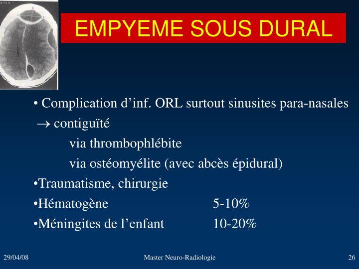 PPT - INFECTIONS CEREBRO-MENINGEES Tableaux Cliniques PowerPoint ...