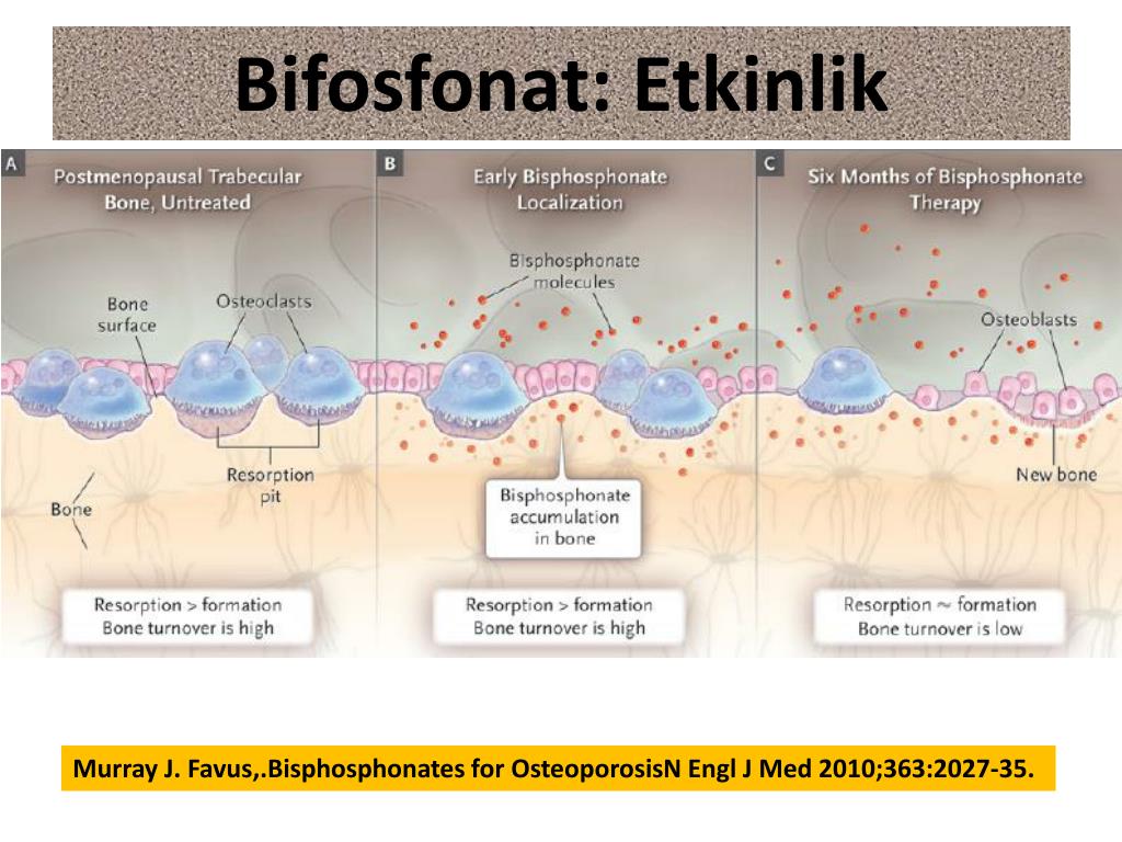 PPT - OSTEOPOROSİSİN ENGELLENMESİNDE BİFOSFONAT KULLANIMI PowerPoint ...