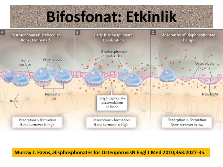 PPT - OSTEOPOROSİSİN ENGELLENMESİNDE BİFOSFONAT KULLANIMI PowerPoint ...