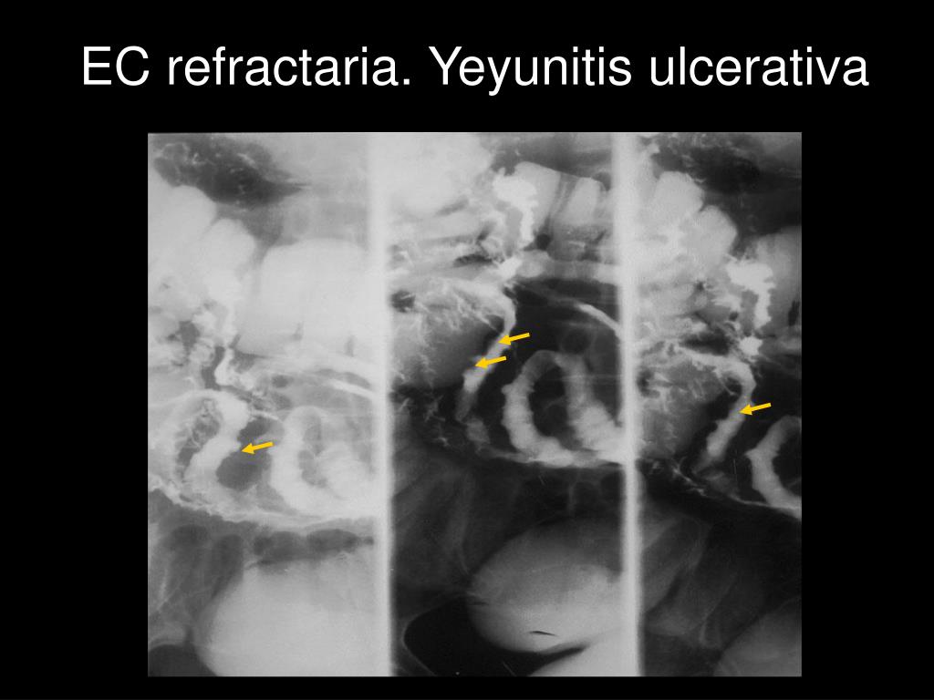 PPT - Prof. Dr. Juan Carlos Gómez Sección de Soporte Nutricional y ...