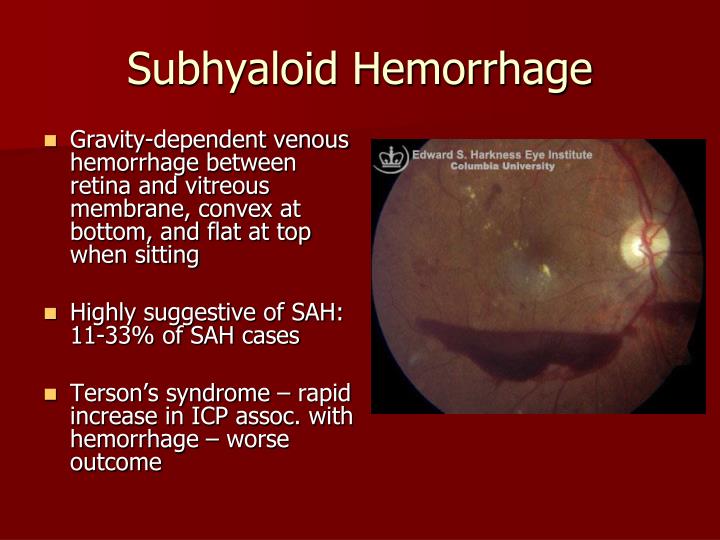 PPT - Headache and Subarachnoid Hemorrhage PowerPoint Presentation - ID:545291