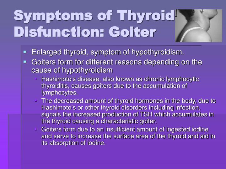 PPT - Thyroid and Anti-Thyroid Drugs PowerPoint Presentation - ID:545403