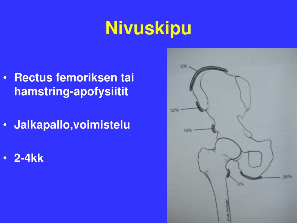 PPT - KASVUIKÄISEN TYYPILLISET RASITUSVAMMAT PowerPoint Presentation ...