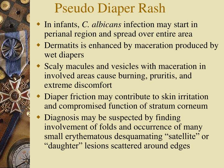 PPT - Chapter 15 Diseases Resulting from Fungi and Yeasts PowerPoint ...
